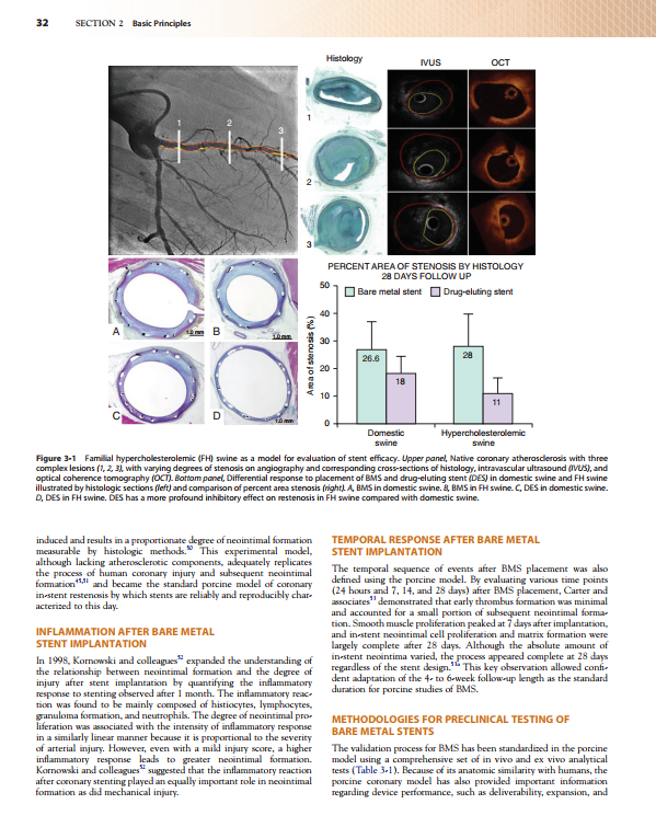 Coronary Stenting: A Companion to Topol’s Textbook of Interventional ...