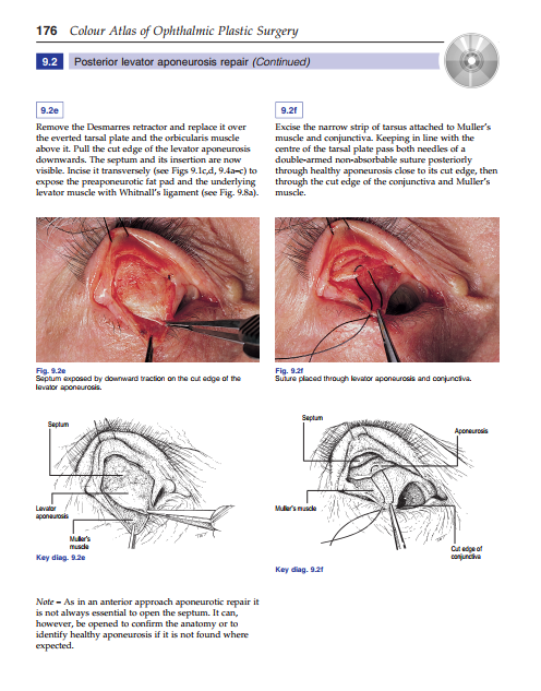 Colour atlas of ophthalmic plastic surgery, 4th Edition (by Anthony G ...