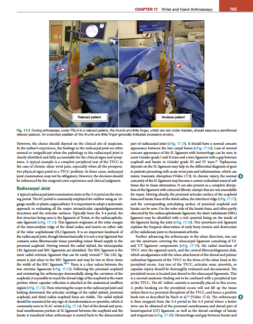 Green’s Operative Hand Surgery 2-Volume Set, 8th Edition (by Scott W. Wolfe ) - Global Health ...