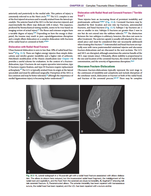 Green’s Operative Hand Surgery 2-Volume Set, 8th Edition (by Scott W ...
