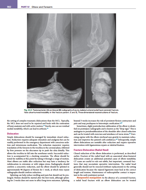 Green’s Operative Hand Surgery 2-Volume Set, 8th Edition (by Scott W ...