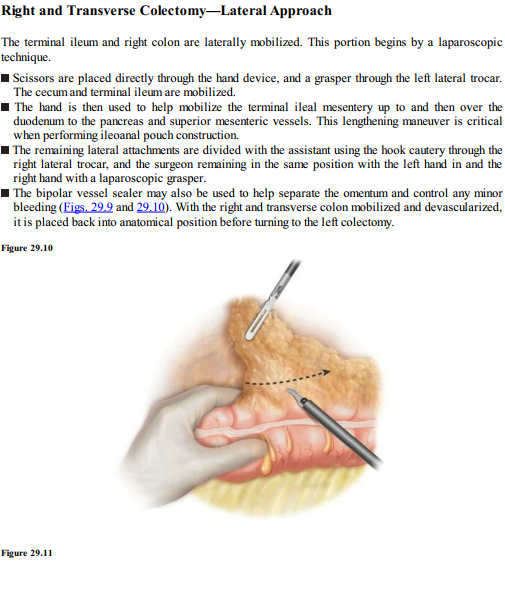 Colon and Rectal Surgery: Abdominal Operations (Master Techniques in ...